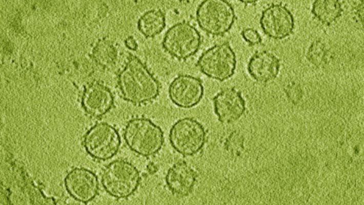 New Vaccine Clears AIDS-Causing Virus in Monkeys | Medicine | Sci-News.com