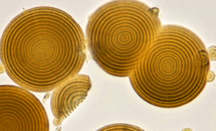 Ooids, Gallstones, Otoliths: Study Provides New Insight into Formation ...