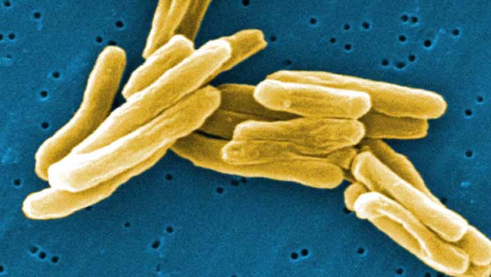 Researchers Find New Way to Inhibit Mycobacterium tuberculosis ...