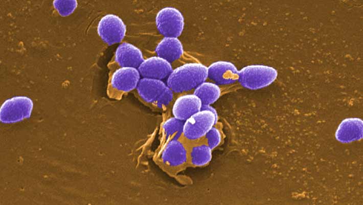 First Enterococci Appeared on Earth during Ordovician Period, Says ...