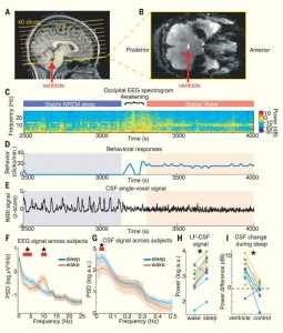 New Study Reveals Key Component in Neurophysiology of Sleep | Sci.News