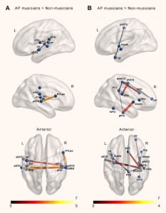 Musicians, Regardless of Innate Pitch Ability, Have More Connected ...