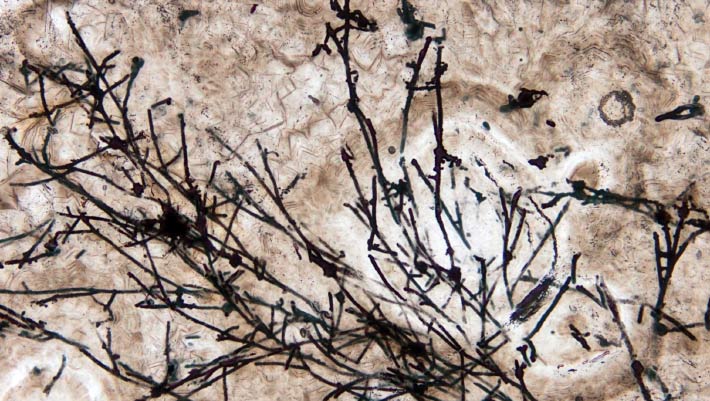 Paleontologists Find 635-Million-Year-Old Land Fungus-Like Fossils ...