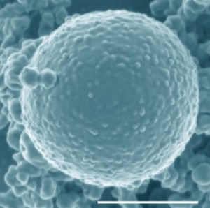 Asgard Archaea and All Eukaryotes Share Common Ancestor, Study Says ...