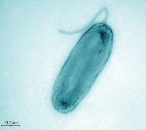 New Legionella Species Discovered in Italy | Sci.News