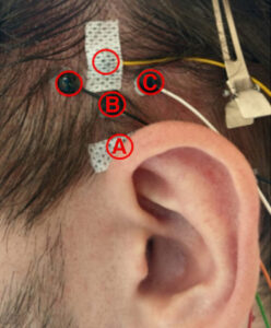 Auricular Muscles Scientists Thought We Didn’t Use Actually Activate ...